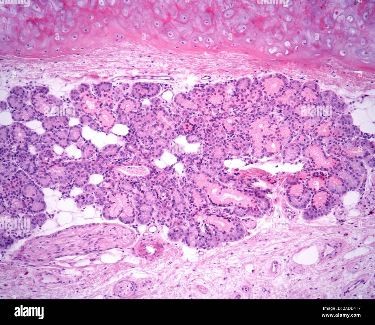 Light micrograph of the laryngeal surface of the epiglottis showing ...