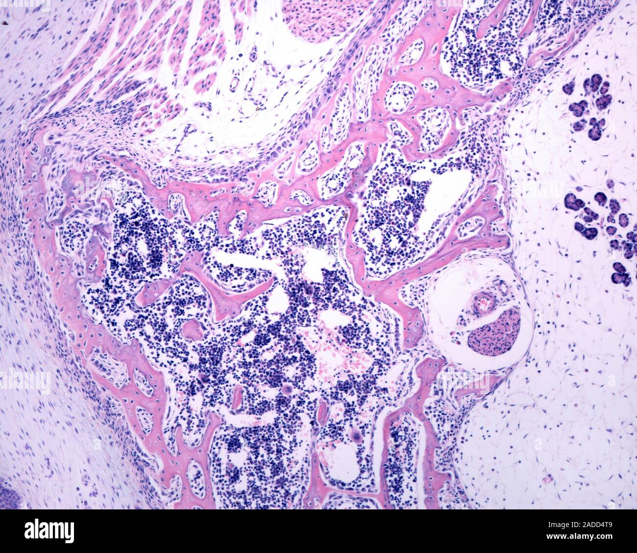 Light micrograph of trabecular bone from a newborn rat jaw made of ...