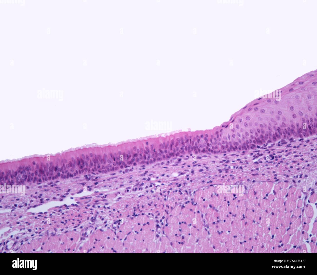High magnification light micrograph showing the transition of epithelia ...