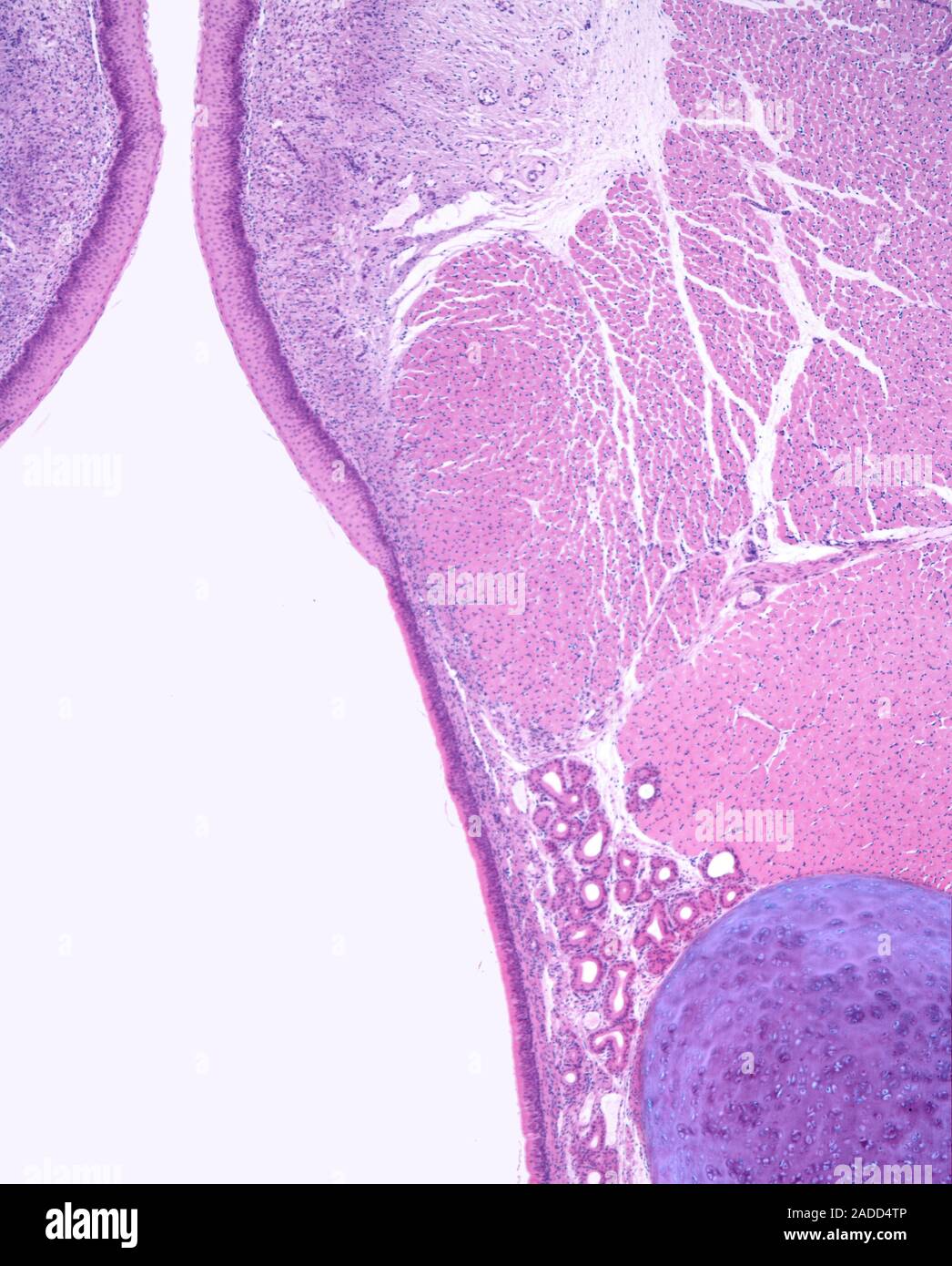 Transition of epithelia between stratified squamous epithelium of the ...