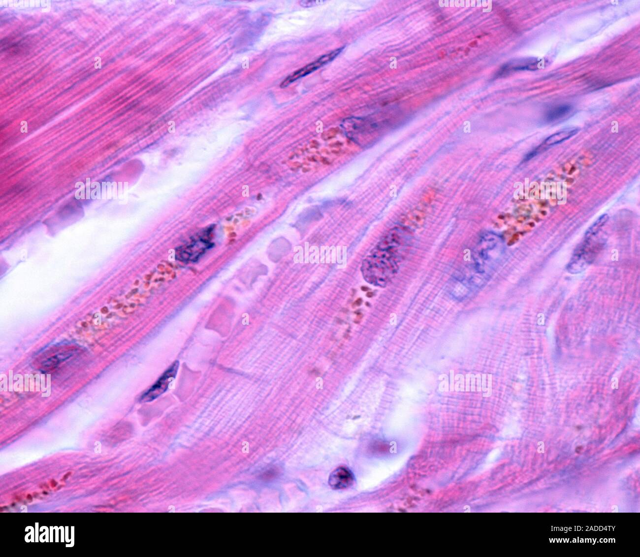 Light micrograph of striated cardiac myocytes showing yellow pigment ...