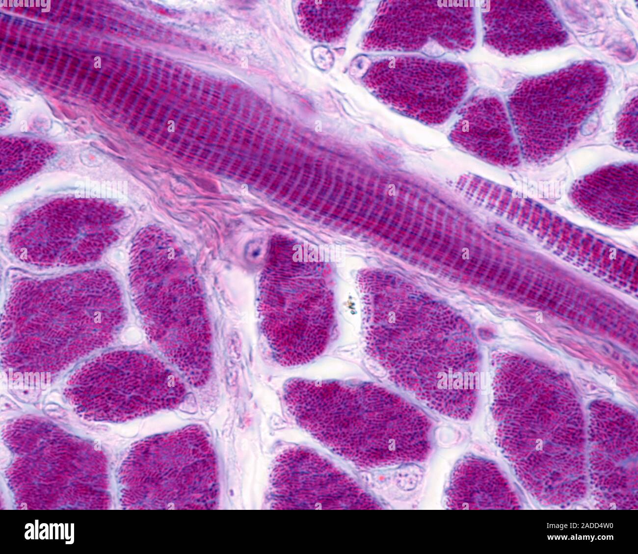 Light Micrograph Of Skeletal Muscle Fibres Of The Tongue Showing The