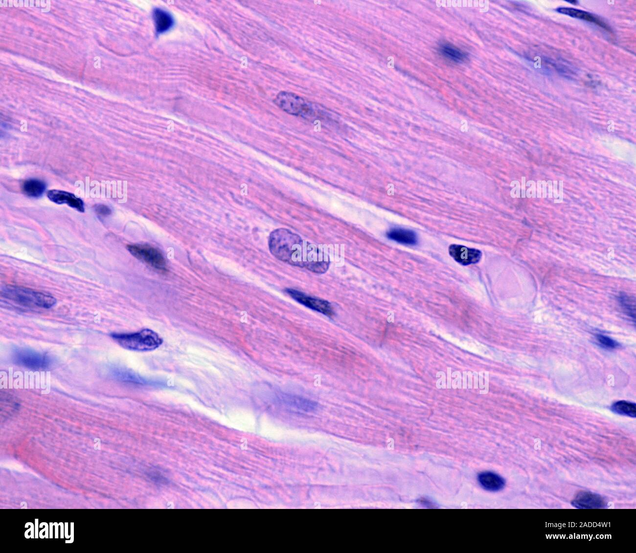 Light micrograph of striated muscle fibres of the heart myocardium. The ...