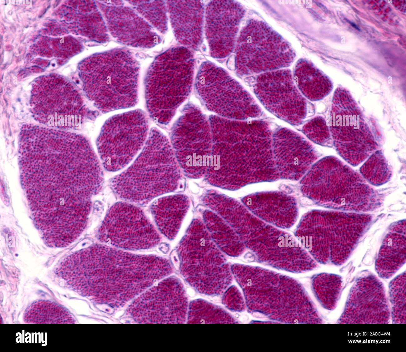 Skeletal muscle fibres in cross section, light micrograph. The dotted ...