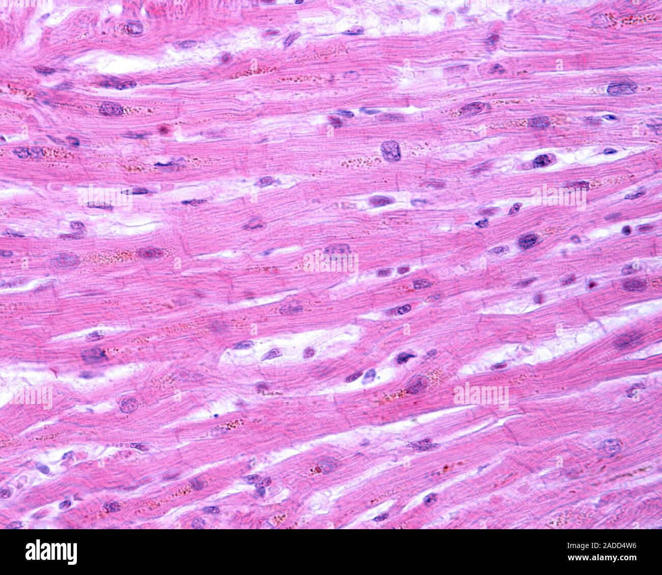 Light micrograph of striated muscle fibres of the heart myocardium ...