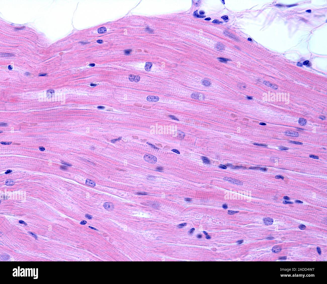 Light micrograph of cross-sectioned striated muscle fibres of the heart ...