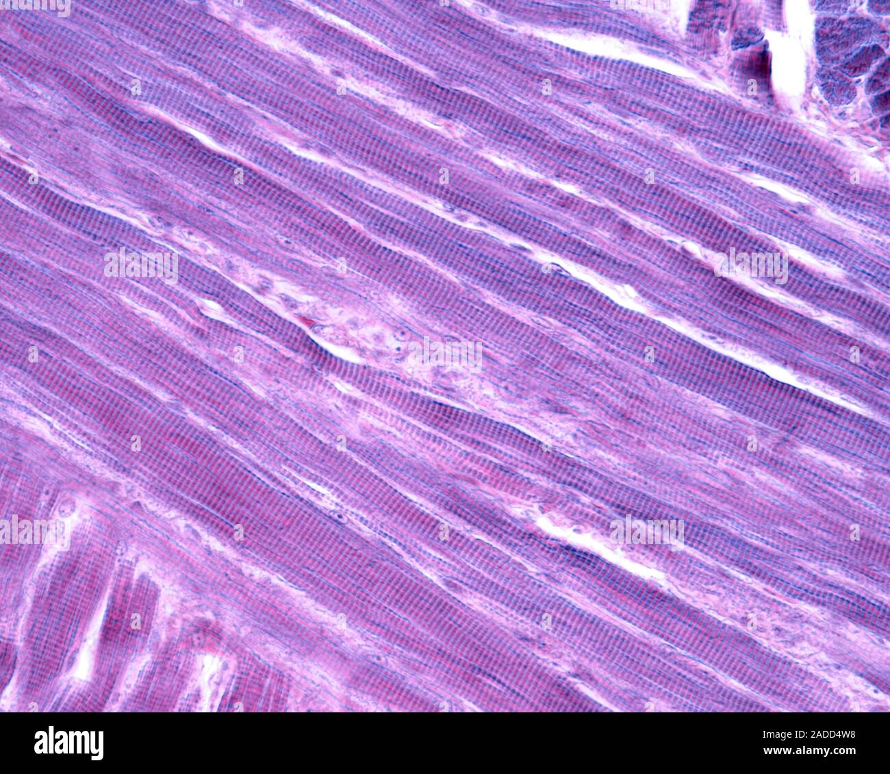 Striated skeletal muscle fibres, light micrograph. Striated skeletal ... Striated skeletal muscle fibres, light micrograph. Striated skeletal ...