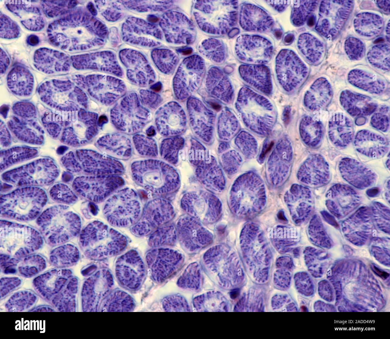 Light micrograph of striated cardiac myocytes showing yellow pigment ...