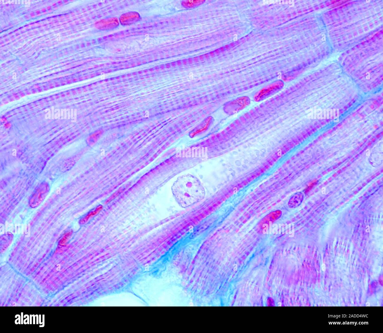Light micrograph of a cardiac muscle cell of the heart myocardium ...