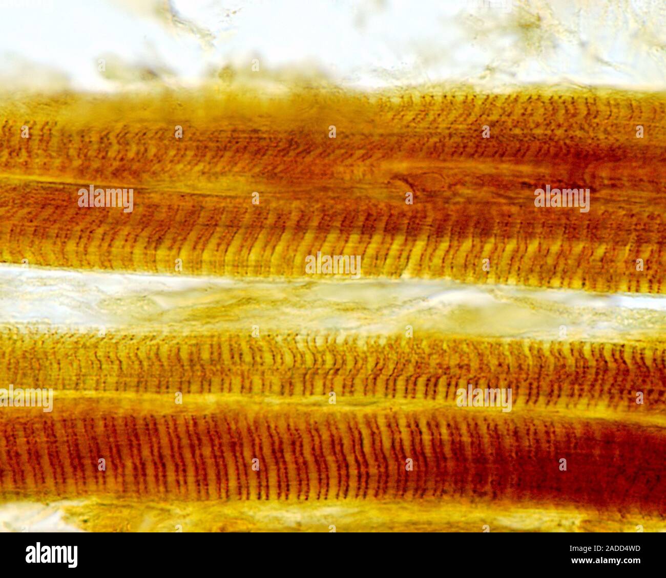 High magnification light micrograph of striated skeletal muscle fibres ...