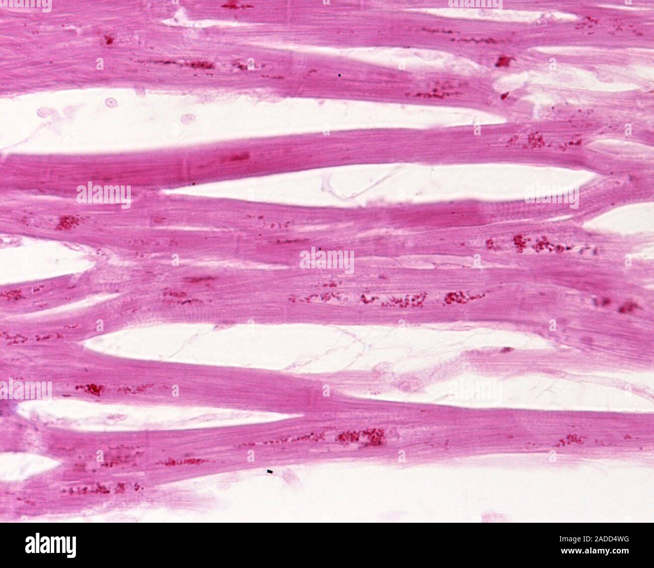 Light micrograph of cardiac myocytes stained with a specific method for ...