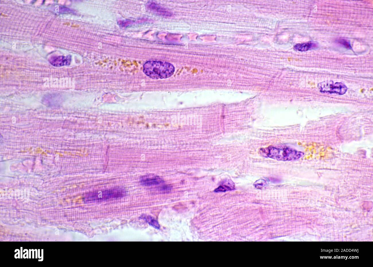 Light micrograph of striated cardiac myocytes showing yellow pigment ...