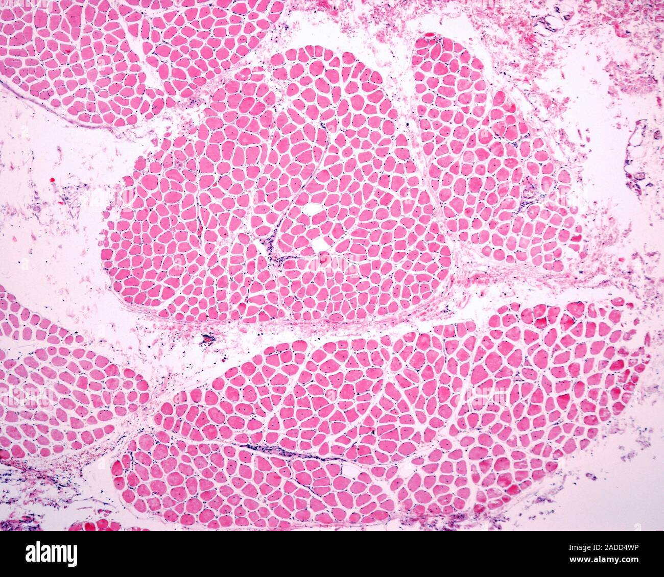 Muscle fibre fascicles, light micrograph. Skeletal muscle fibres are ...