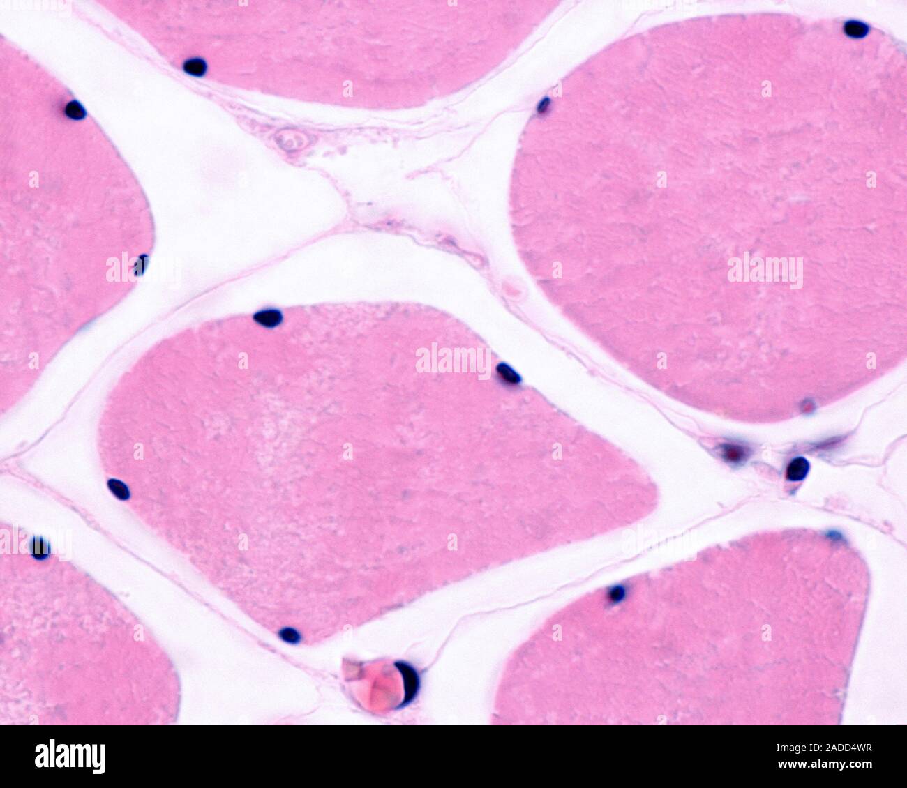 Skeletal muscle fibre endomysium, light micrograph. Skeletal striated ...