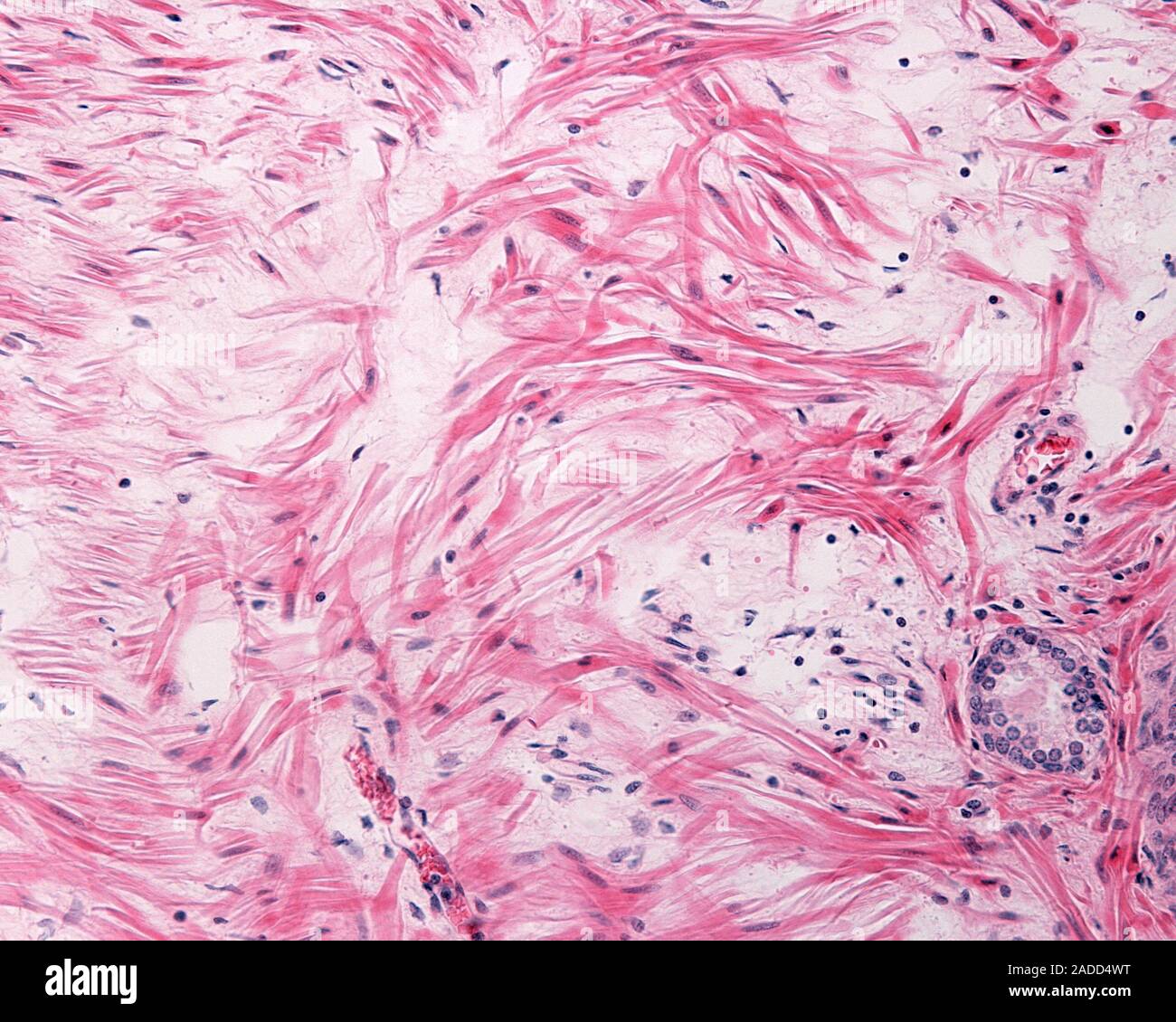 Light micrograph of smooth muscle fibres from the wall of a human ...