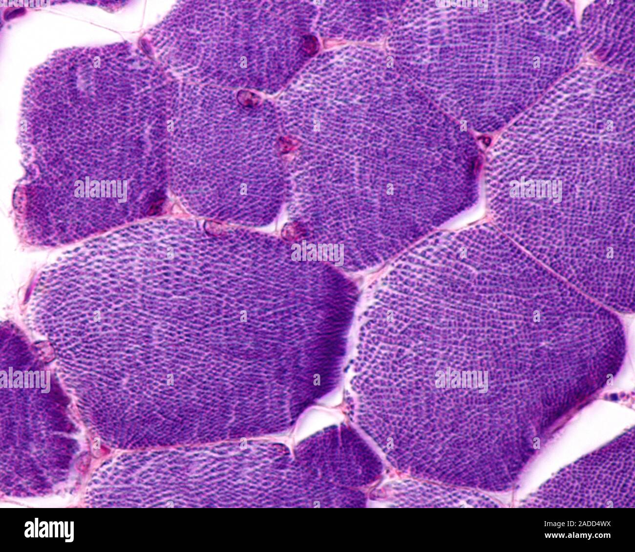 Light Micrograph Of Cross Sectioned Skeletal Muscle Fibres Showing The