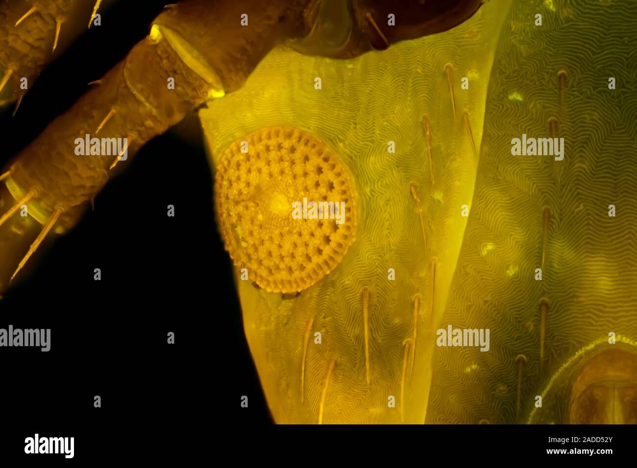 Light micrograph of a tick (family Ixodidae) spiracle. Microscopic ...