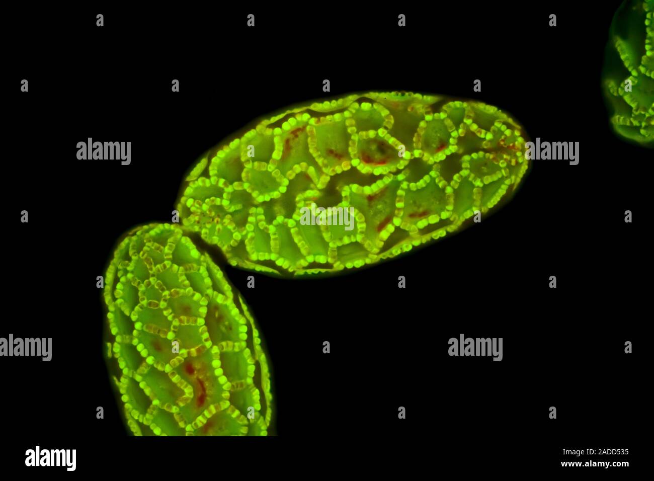 Light micrograph showing grains of lily (Lilium sp.) pollen ...