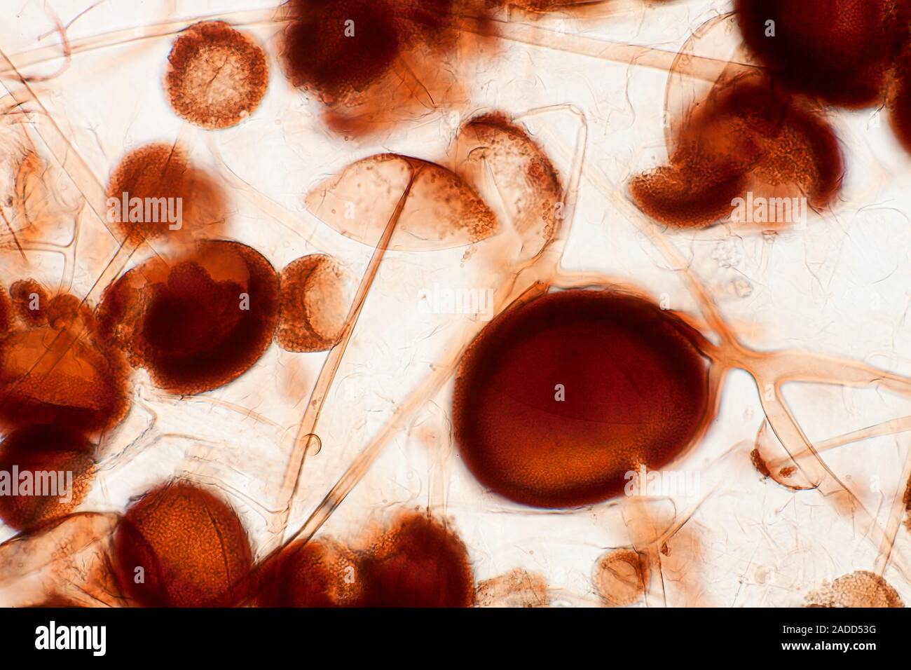 Light micrograph of the common mould Mucor mucedo, showing its thread ...