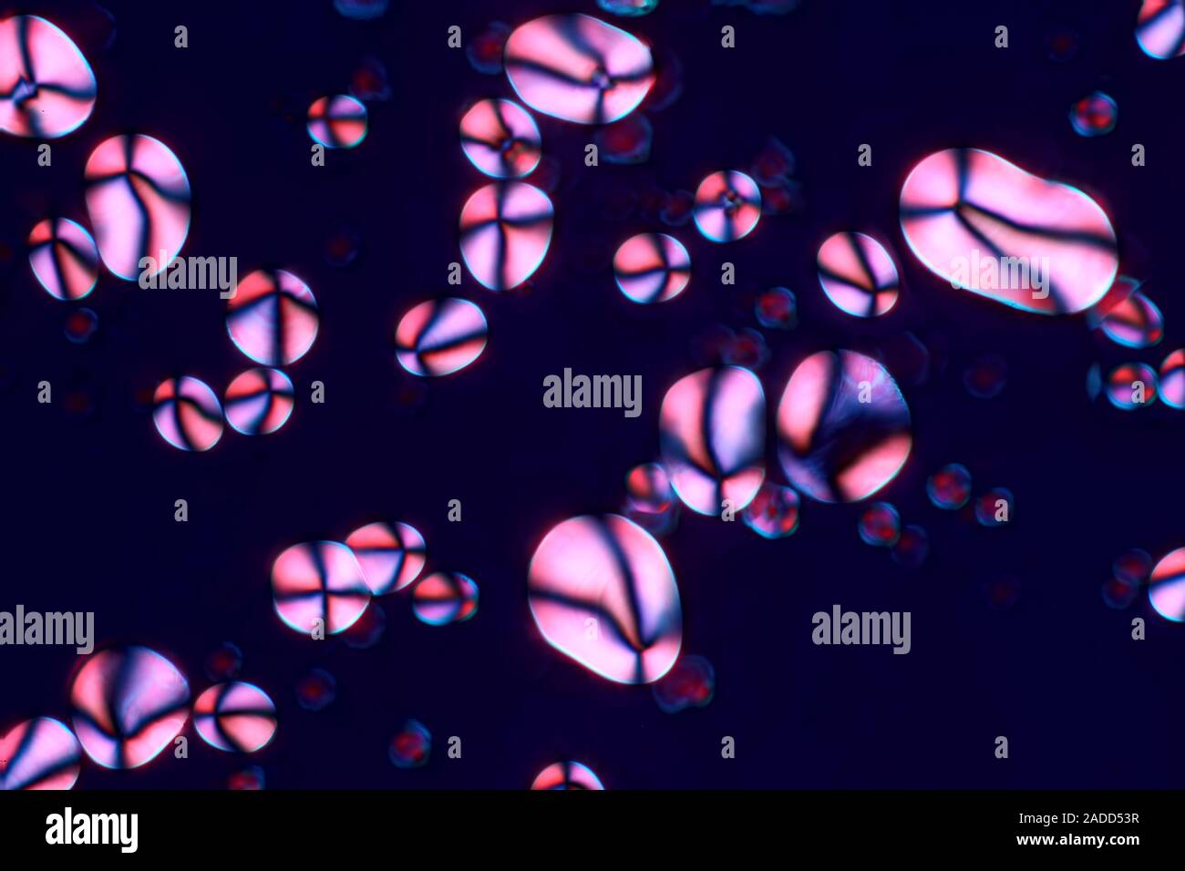 Potato starch grains. Polarised light micrograph of starch grains from ...