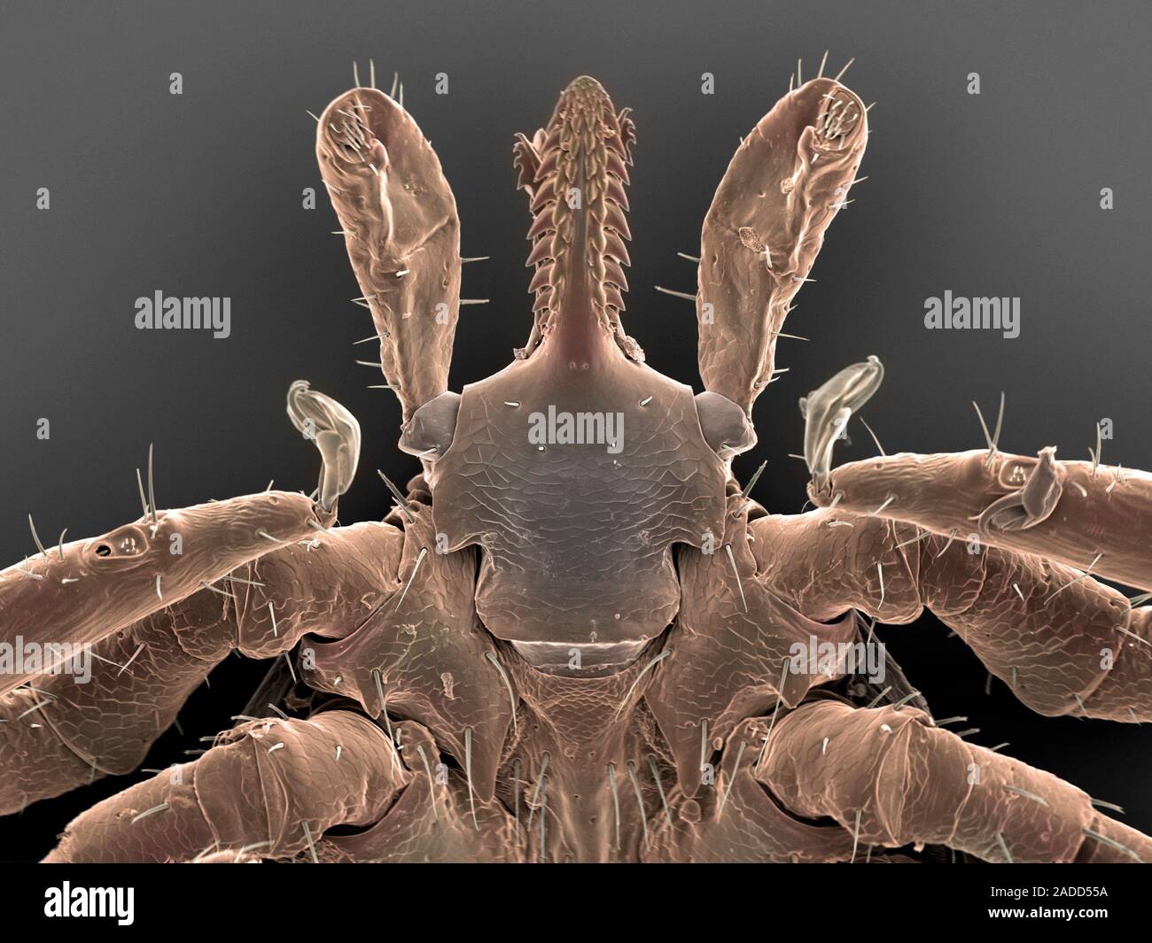 Coloured scanning electron micrograph (SEM) of a sheep tick (Ixodes ...