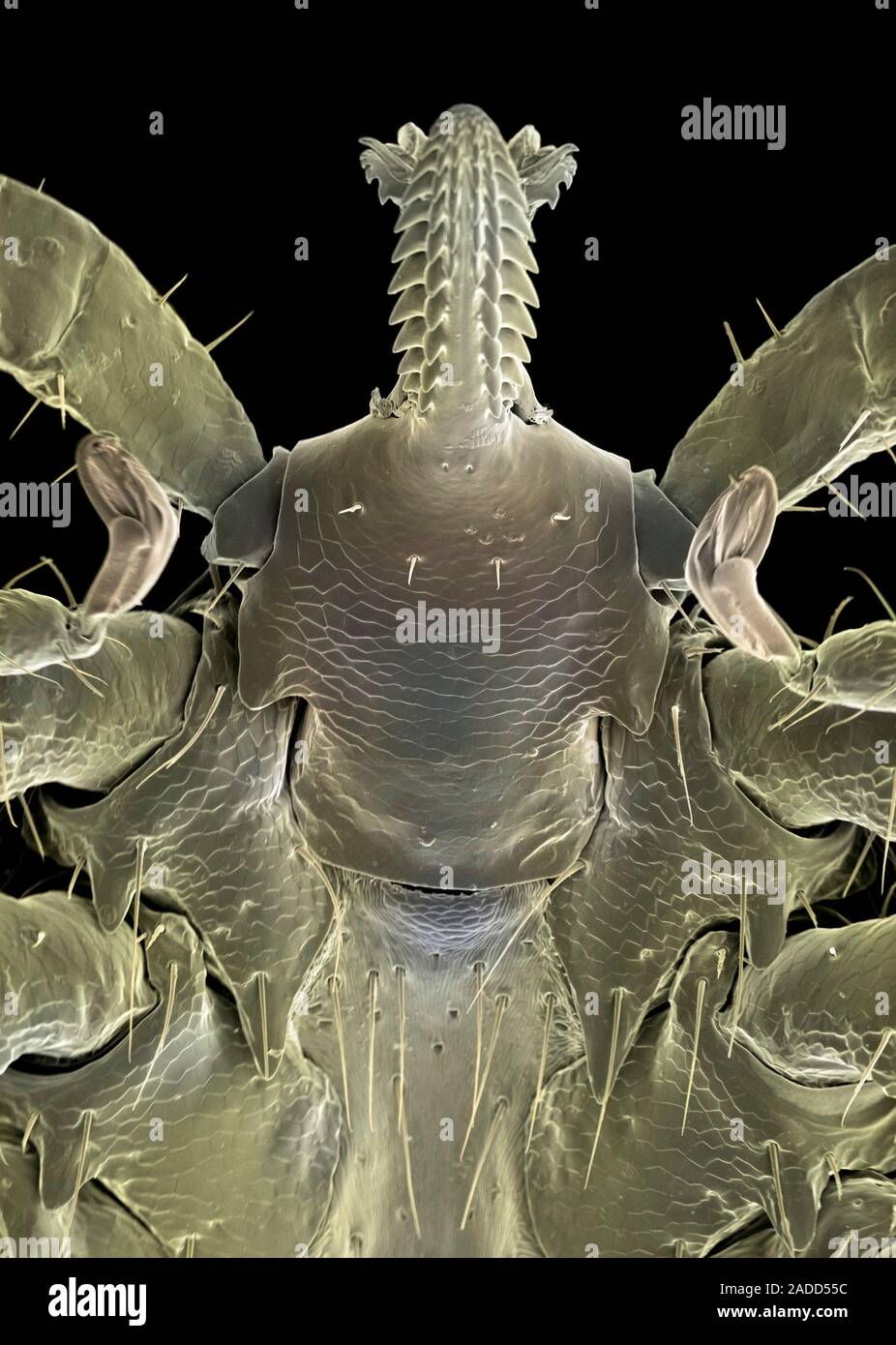 Coloured scanning electron micrograph (SEM) of a sheep tick (Ixodes ...