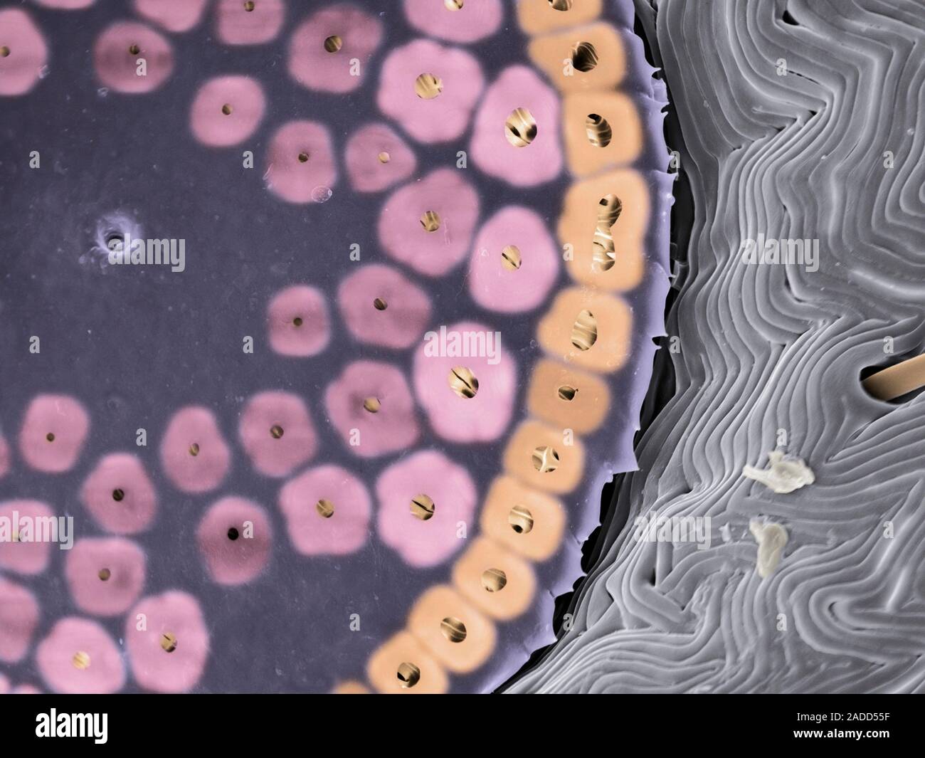 Coloured scanning electron micrograph (SEM) of a sheep tick (Ixodes ...