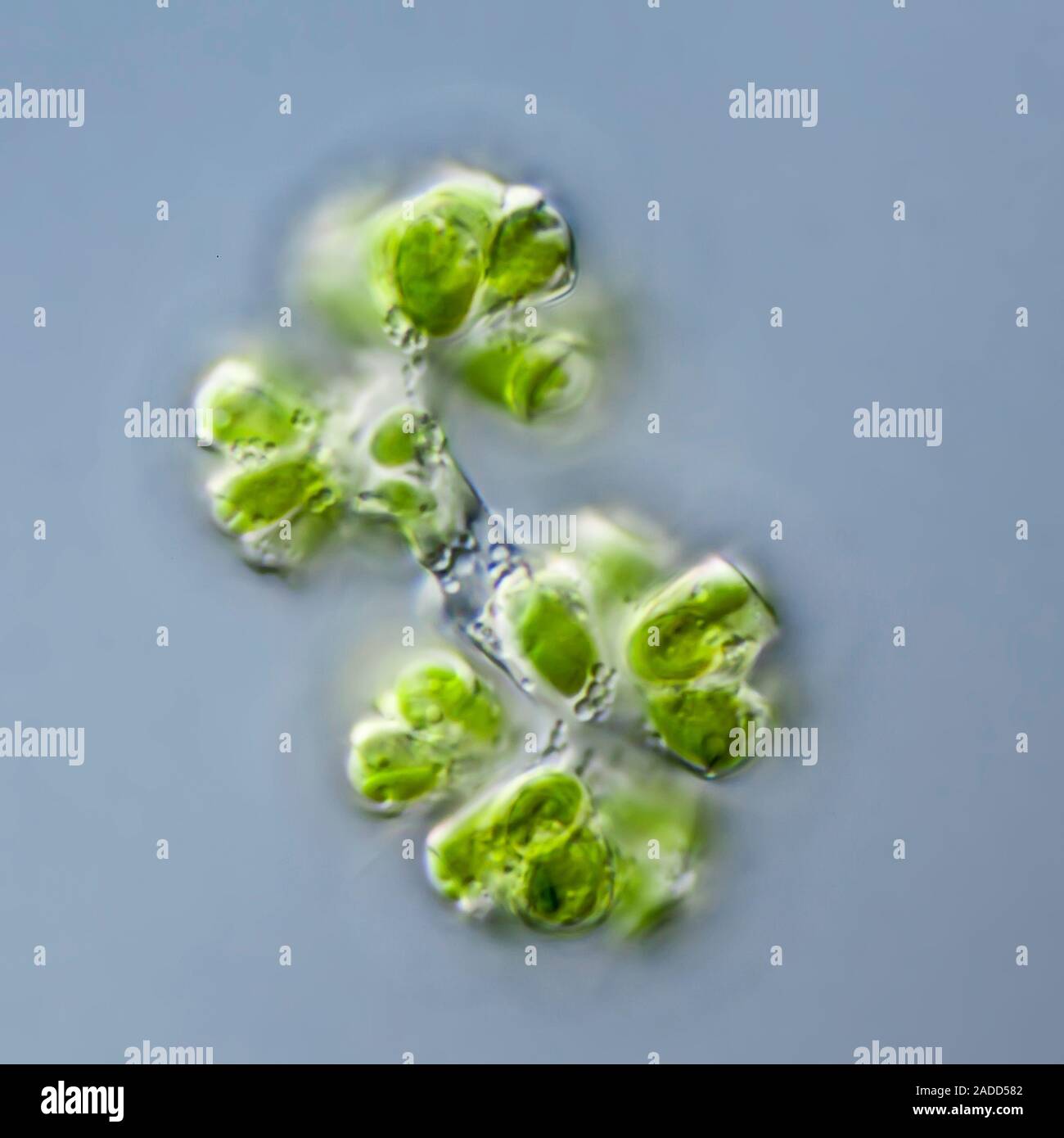 Light micrograph of Botryococcus sp. freshwater algae. Botryococcus ...