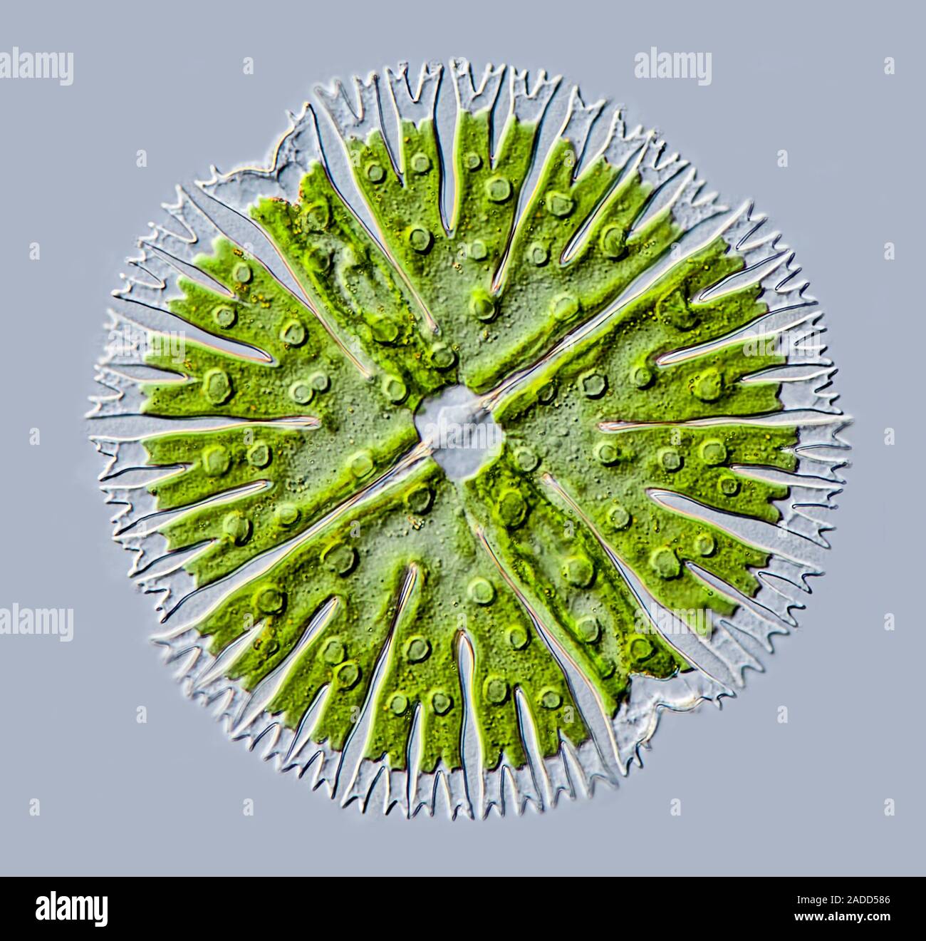 Light micrograph of Micrasterias radiosa, a freshwater green alga ...