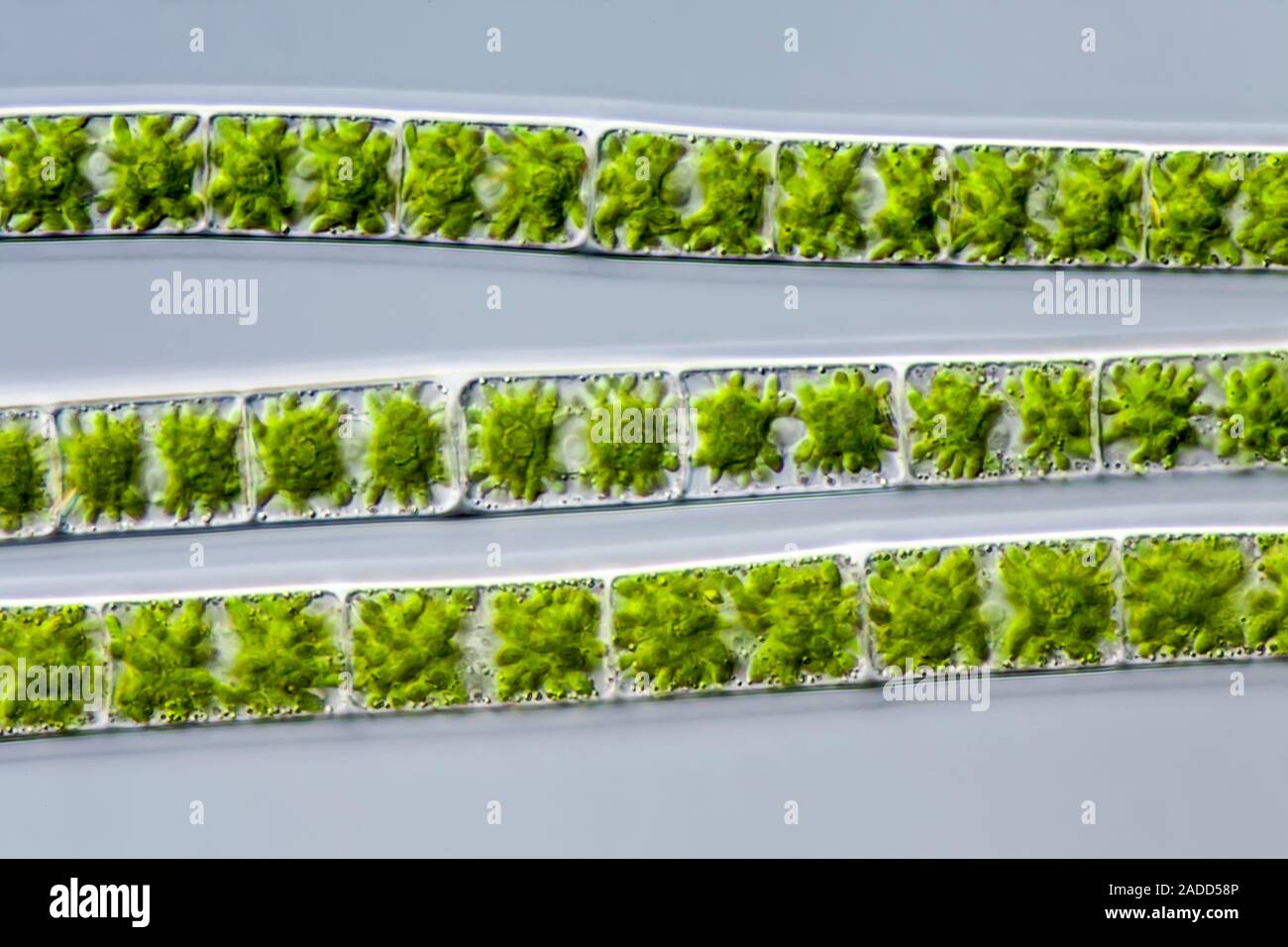 Light micrograph of Zygnema sp. freshwater filamentous green algae ...
