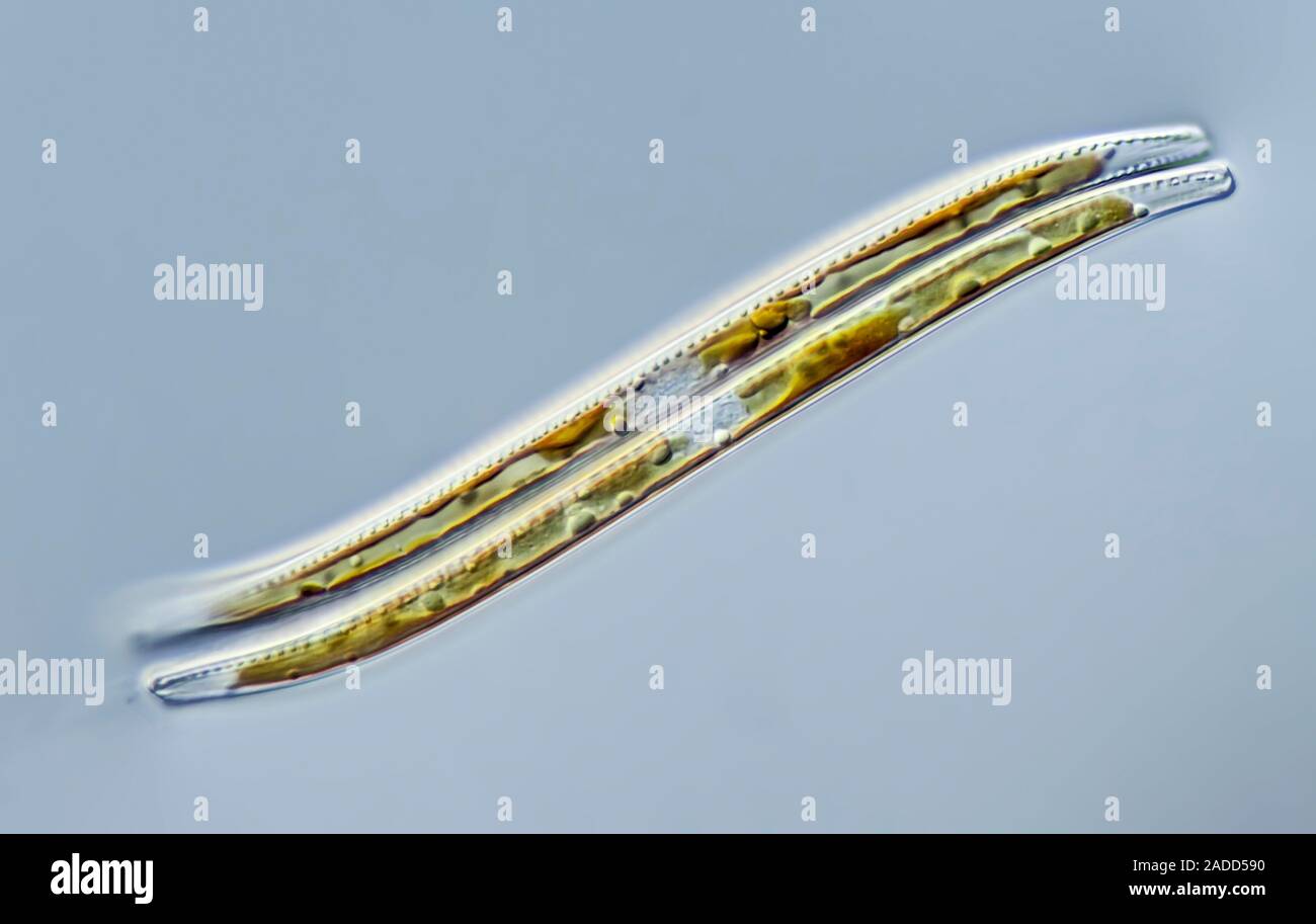 Light micrograph of Gyrosigma sp. freshwater diatoms. Culture material ...