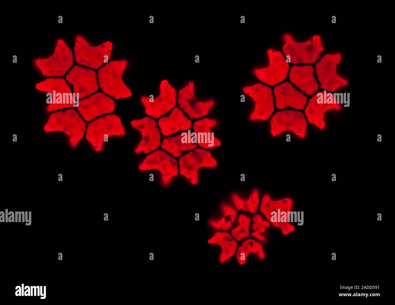 Light micrograph of Pediastrum sp. green algae, showing intense red ...