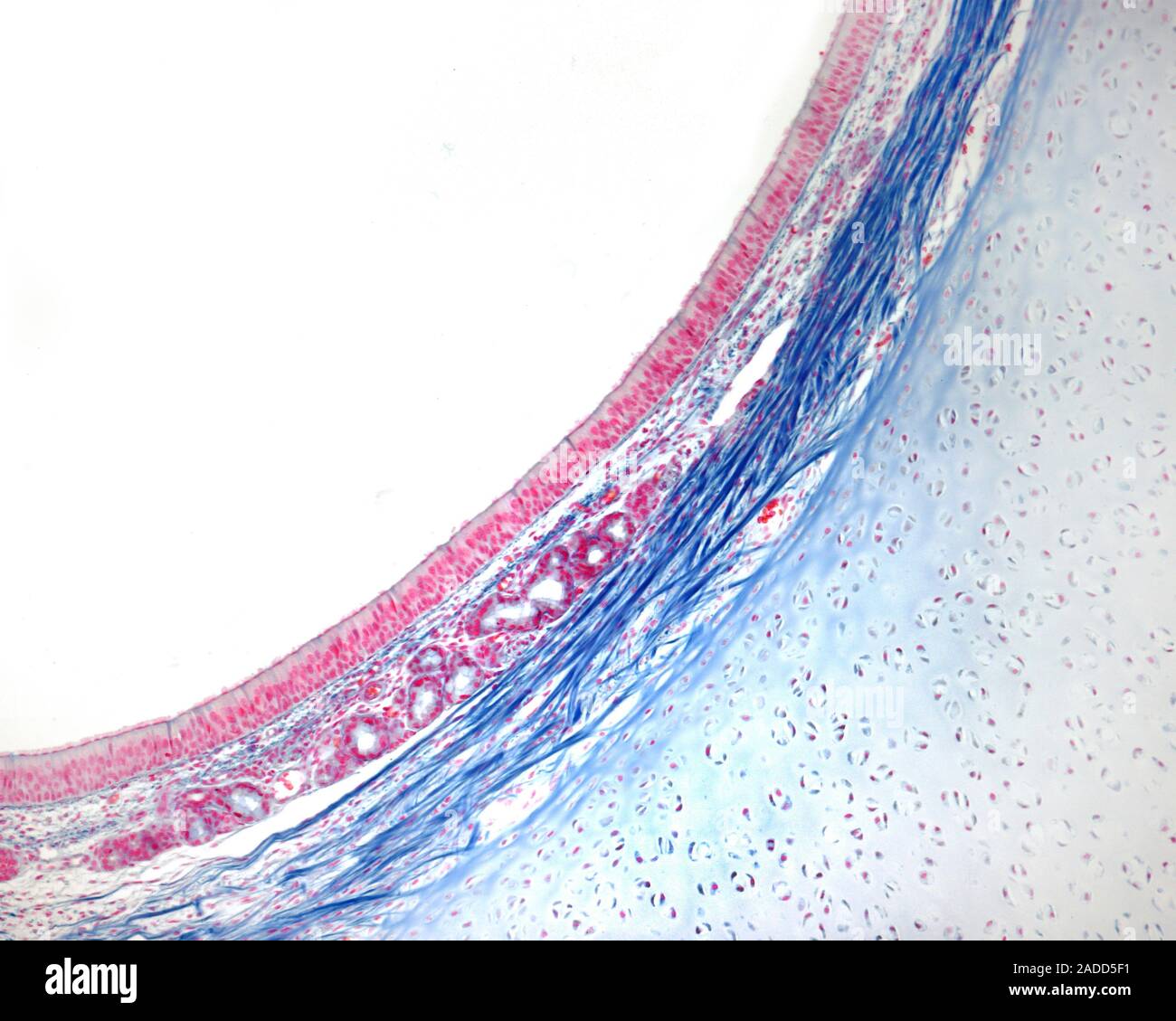 Layers of trachea wall, light micrograph. The uppermost layer is the ...