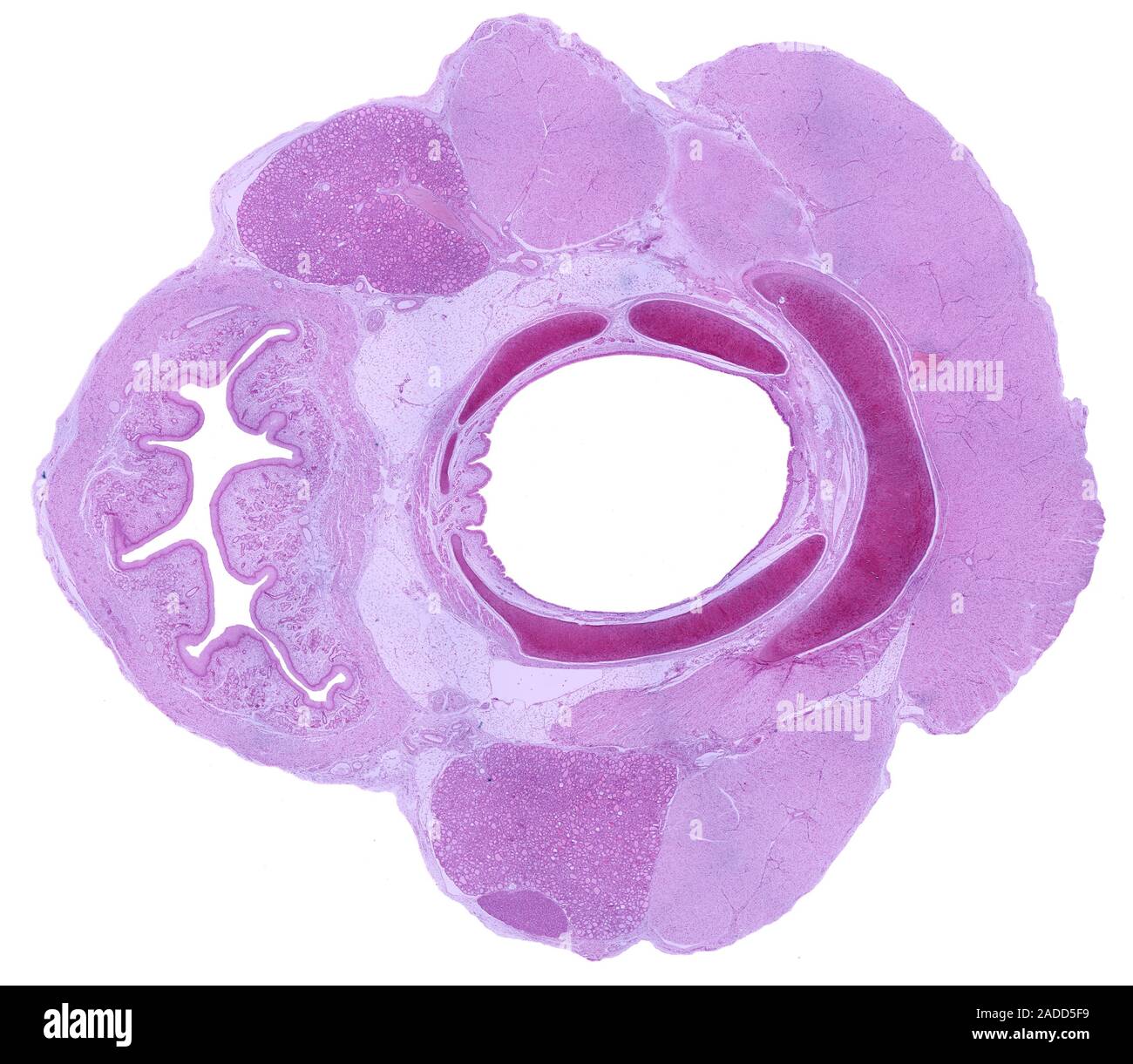 Layers of trachea wall, light micrograph. At upper left is the mucosa ...