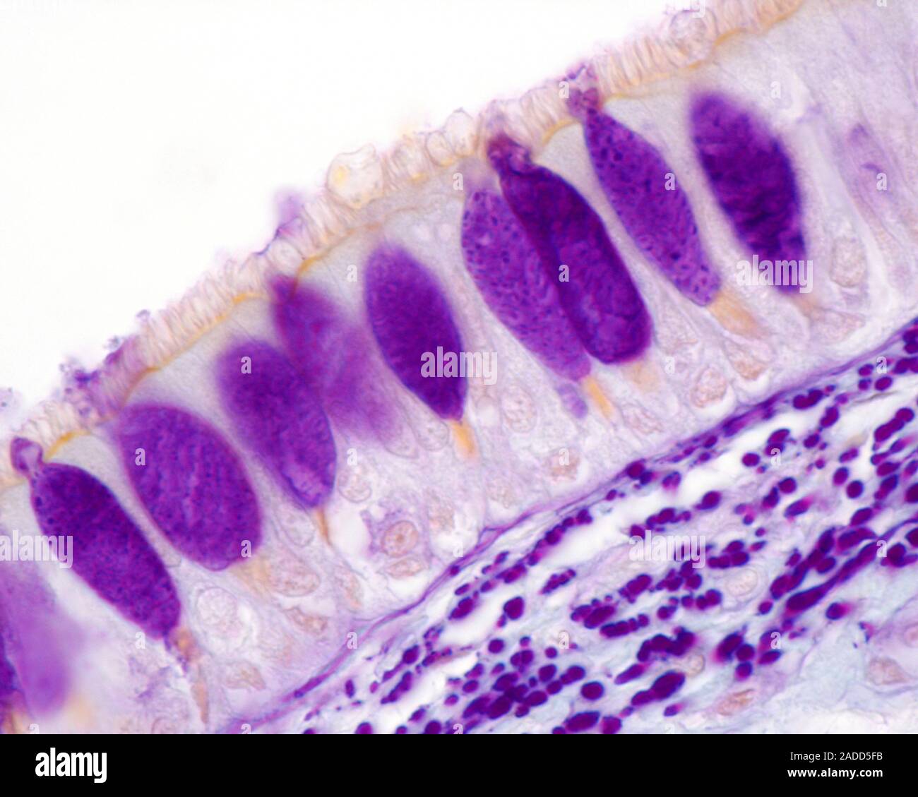 Layers of trachea wall, light micrograph. At upper left is the mucosa ...