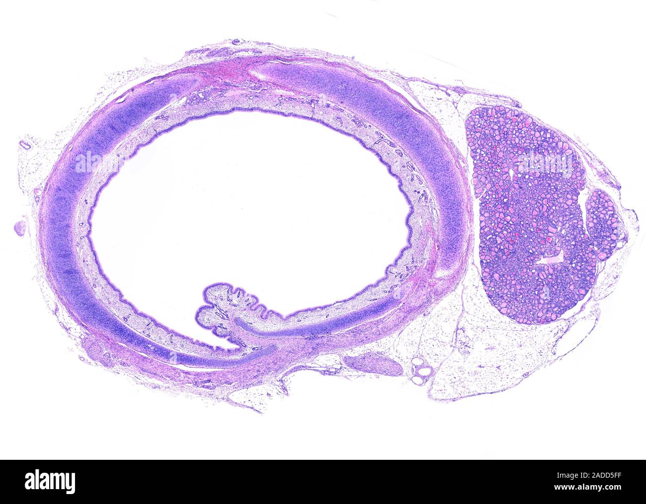 Trachea and thyroid, light micrograph. Cross-section of a Gabe stained ...