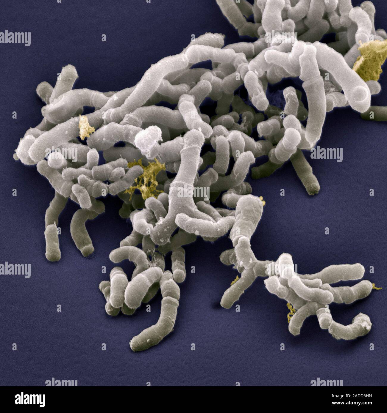 Bifidobacterium Gram Stain