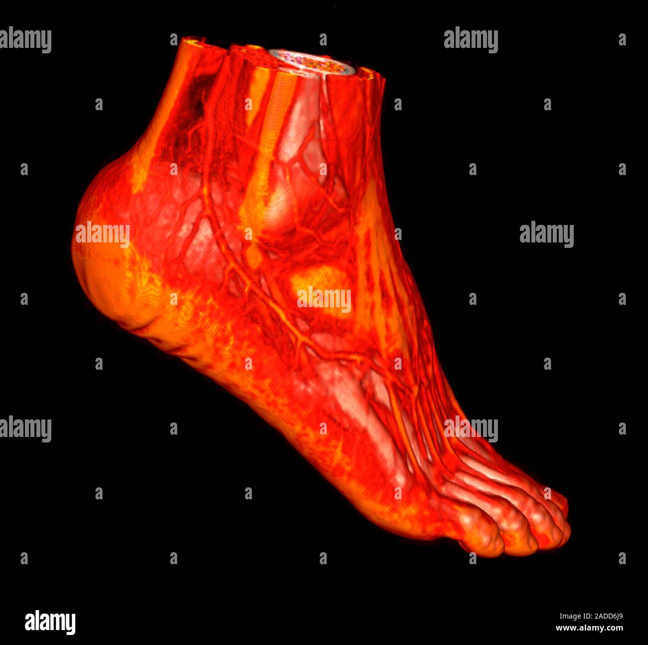 Human ankle and foot, 3D coloured computed tomography (CT) scan. This ...
