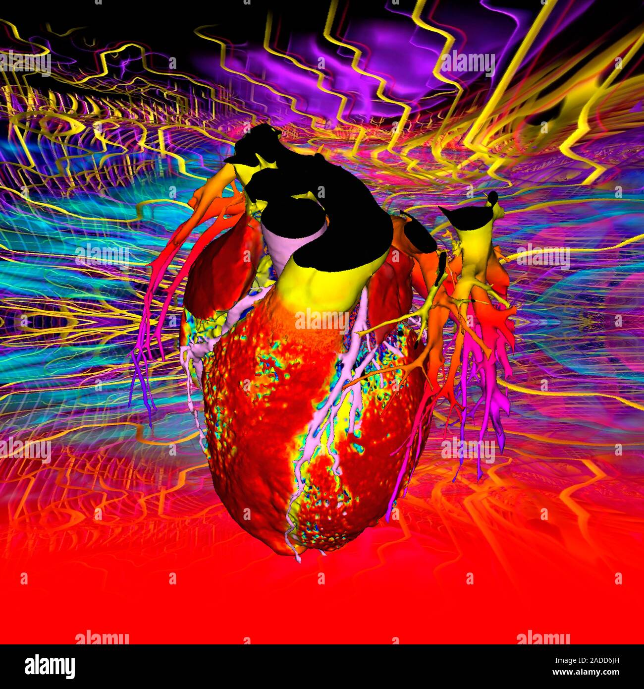 Human heart, 3D coloured computed tomography (CT) angiogram with a ...