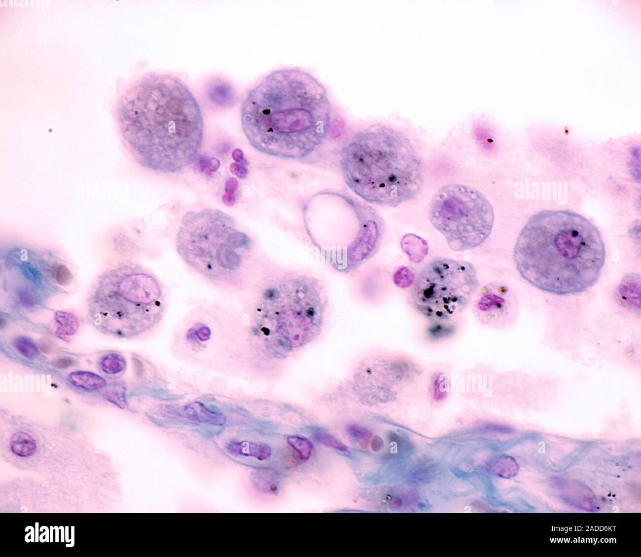 High magnification light micrograph showing large rounded alveolar ...