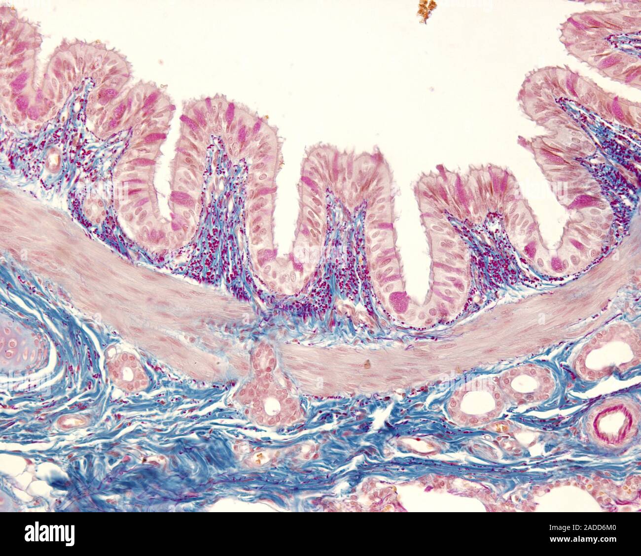 Light micrograph of a bronchus wall. From top to bottom: respiratory ...