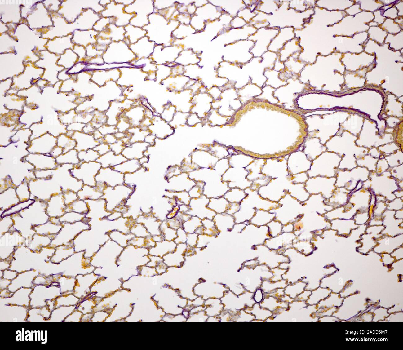 Low magnification light micrograph showing elastic fibres and the ...
