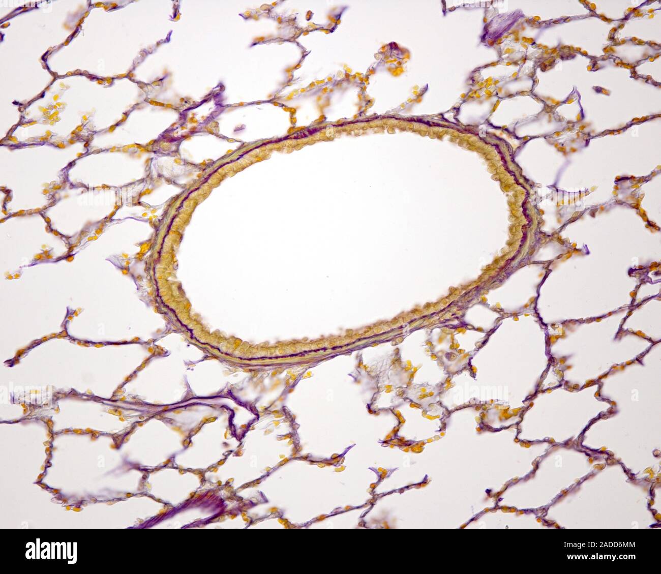 Bronchiole, light micrograph. Elastic fibres in the wall of a pulmonary ...