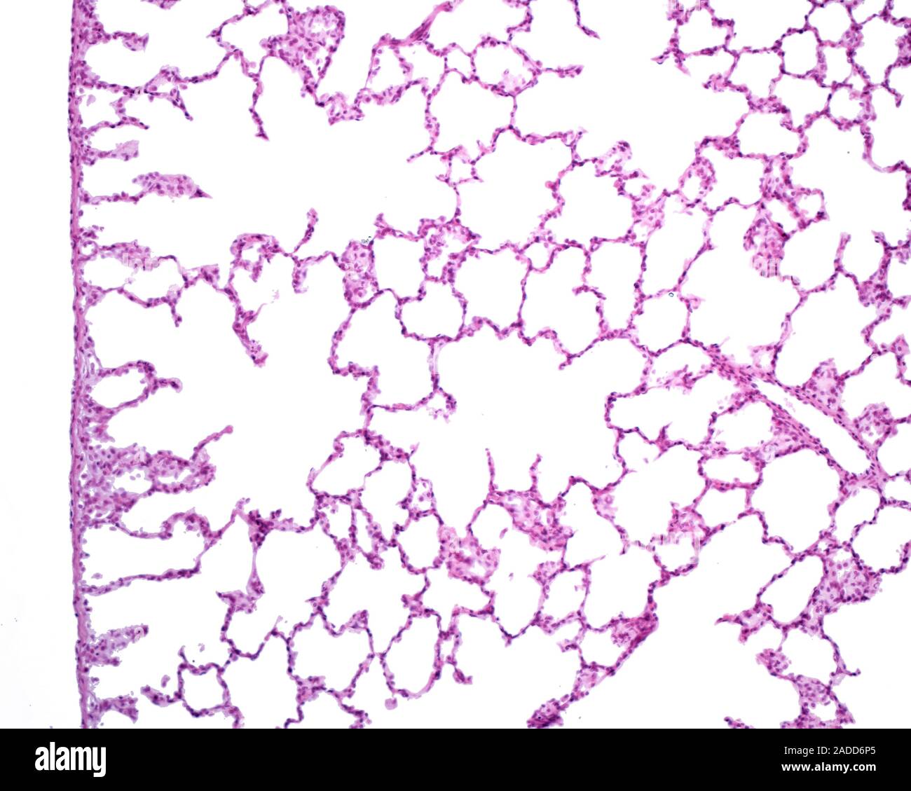 Lung Histology Alveoli