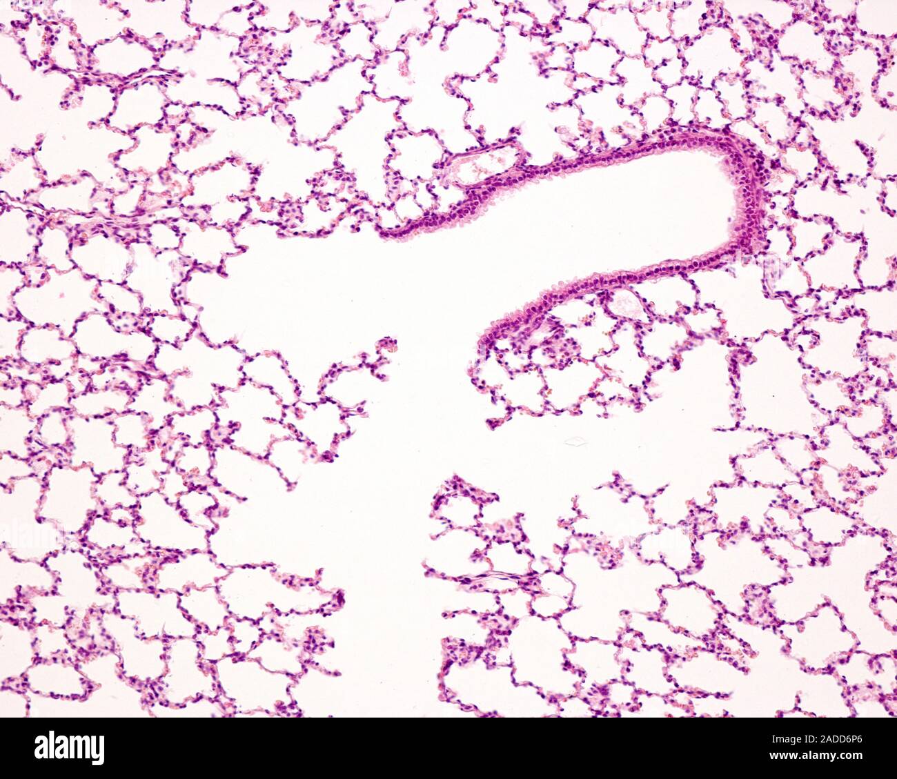 Light micrograph of lung tissue at the bifurcation of a bronchiole. It ...