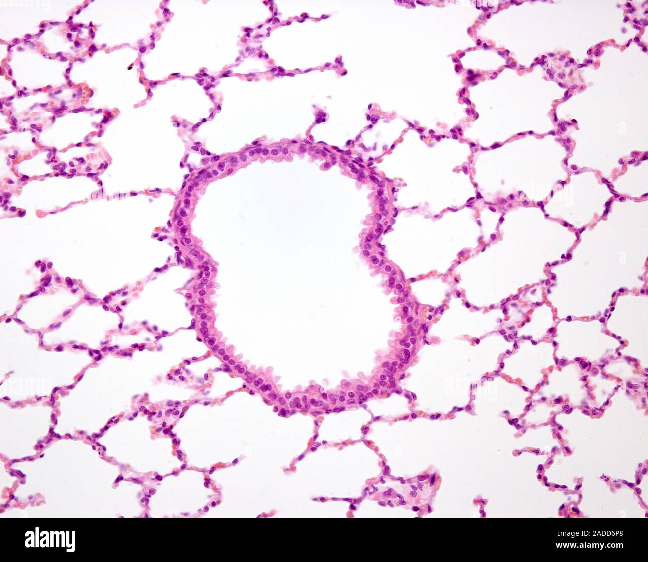Light micrograph of a cross-sectioned terminal bronchiole. It is lined ...