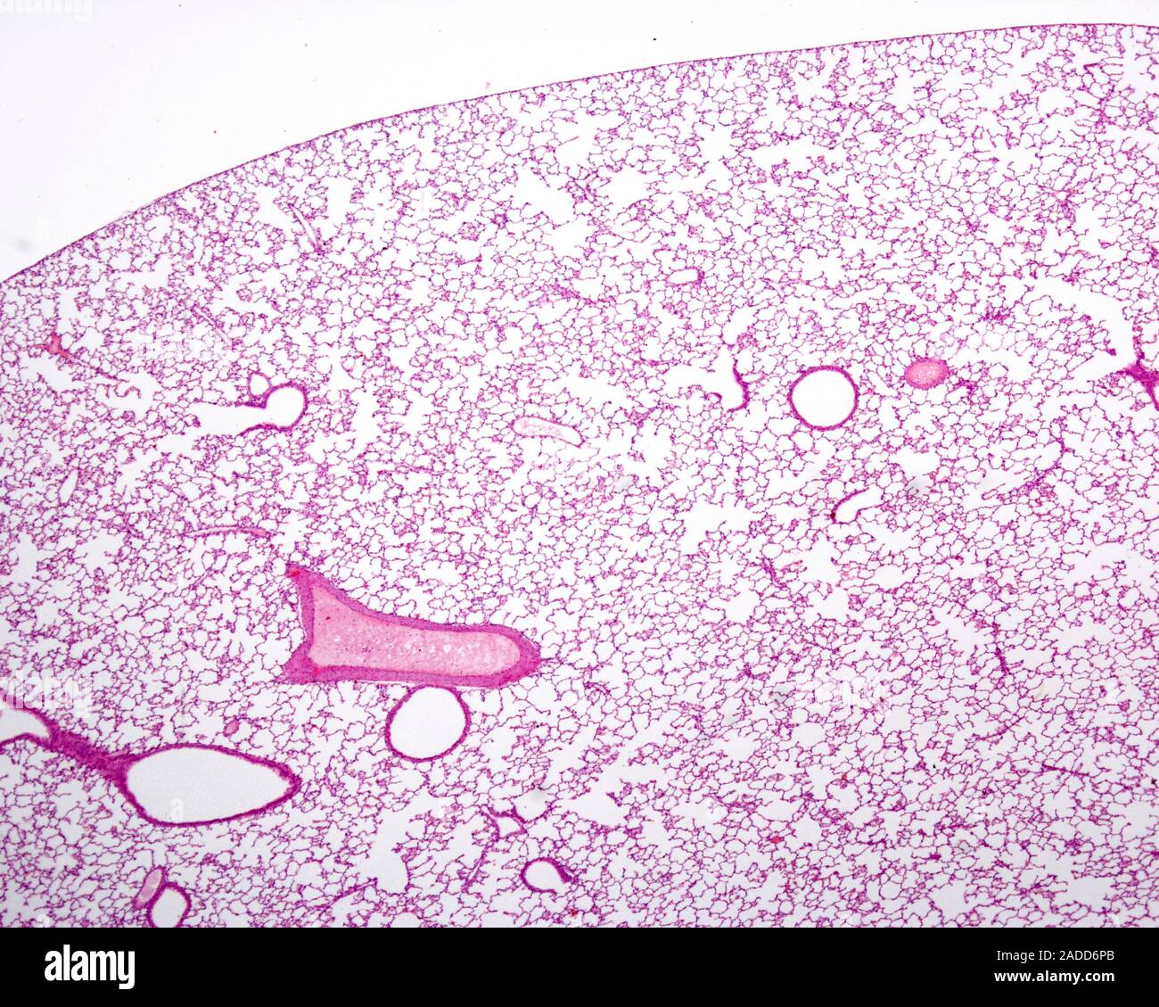 Low magnification light micrograph showing the typical fine lace ...