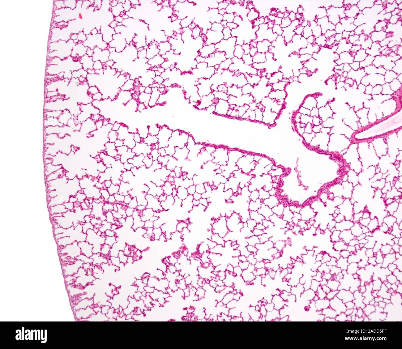 Light micrograph showing the finest branches of the lower airway, the ...