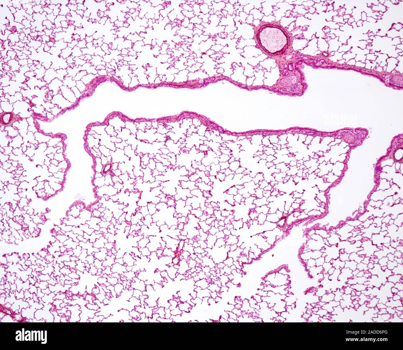Light micrograph showing the finest branches of the lower airway, from ...