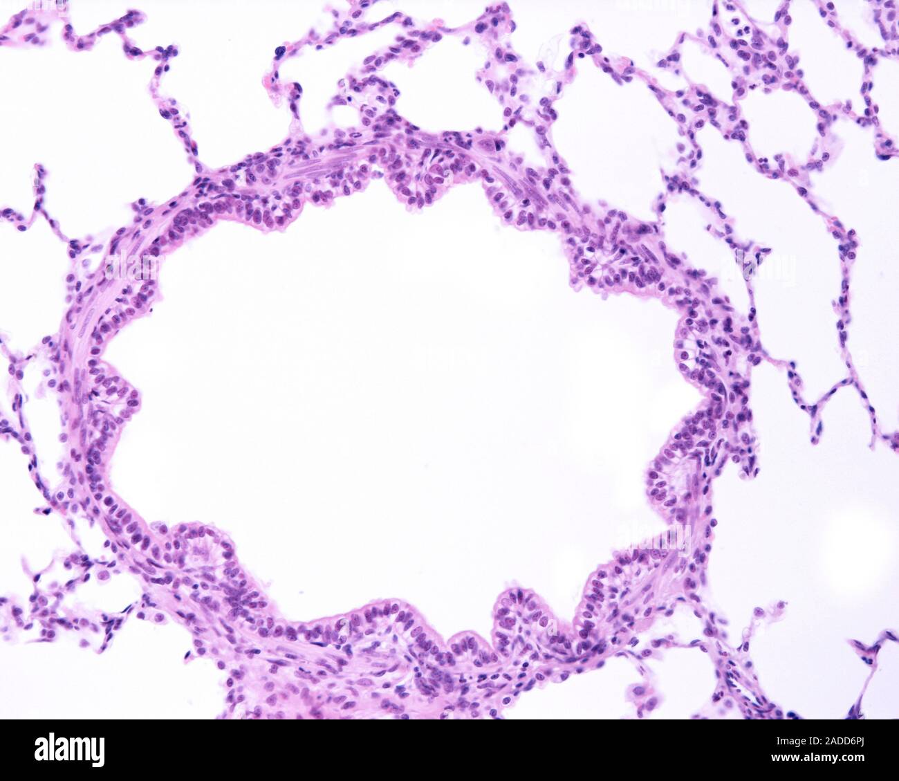 Light micrograph of a cross-sectioned terminal bronchiole. It is lined ...